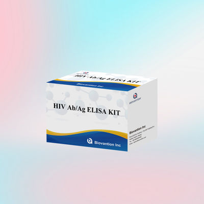 IVD reagent HIV Ab Ag Elisa Test Kits With 18-Month Shelf Life And High ...