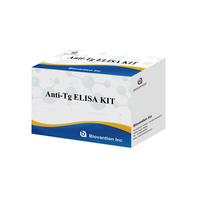 Elisa Diagnostic Kit For Human Antithyroglobulin Antibodies Anti-Tg For ...