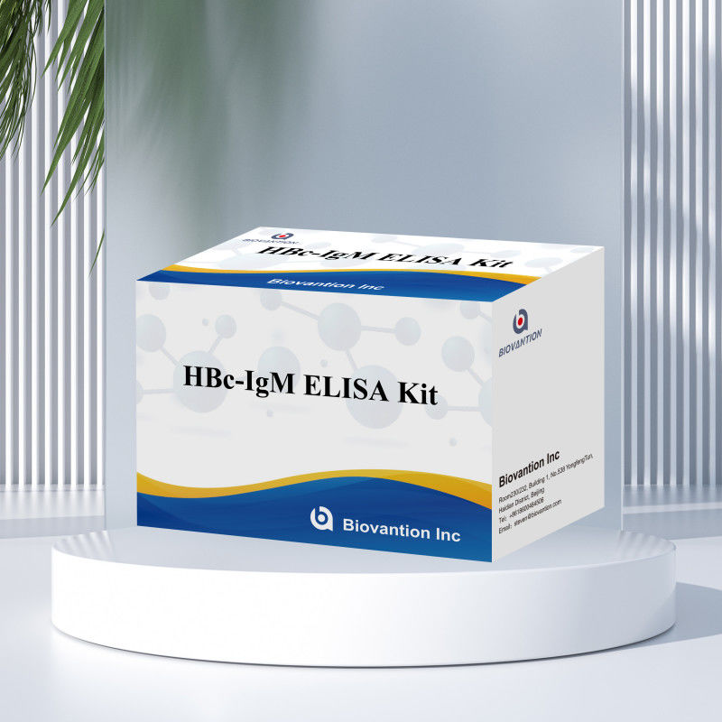 High Accuracy HBc IgM Anthgen Diagnostic Reagent Test With Enzyme ...