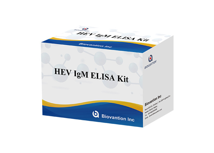 HEV IgM Elisa Test Kit Serum Vs Plasma For Antibody Detection